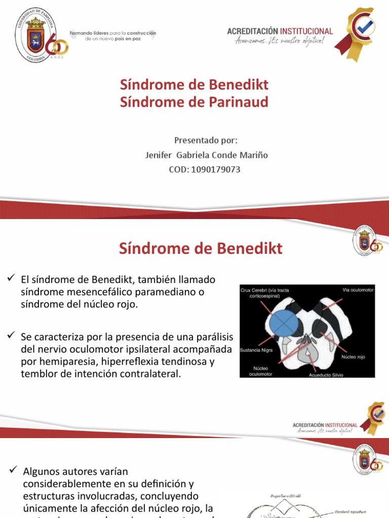 Sindrome de Benedikt y Parinaud | PDF | Medicina | Neurología