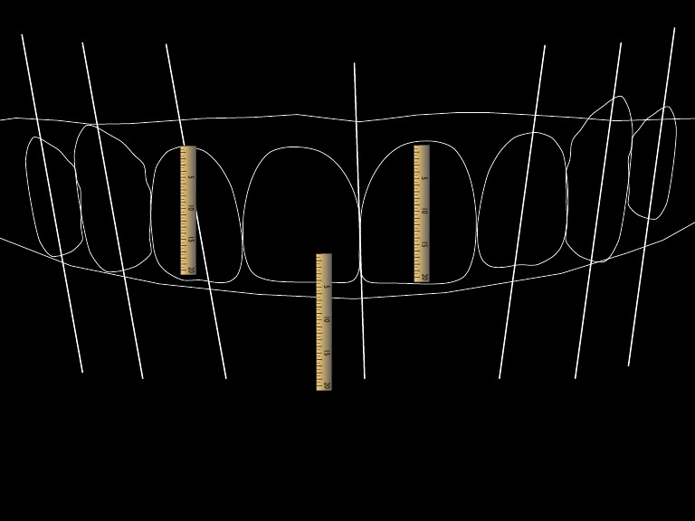 DSD Power Point | PDF