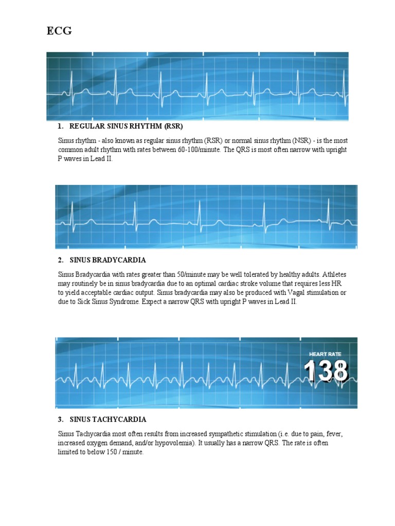 Ecg Notes | PDF | Electrocardiography | Cardiac Arrhythmia