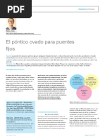 TiPos D Ponticos | PDF | Diente