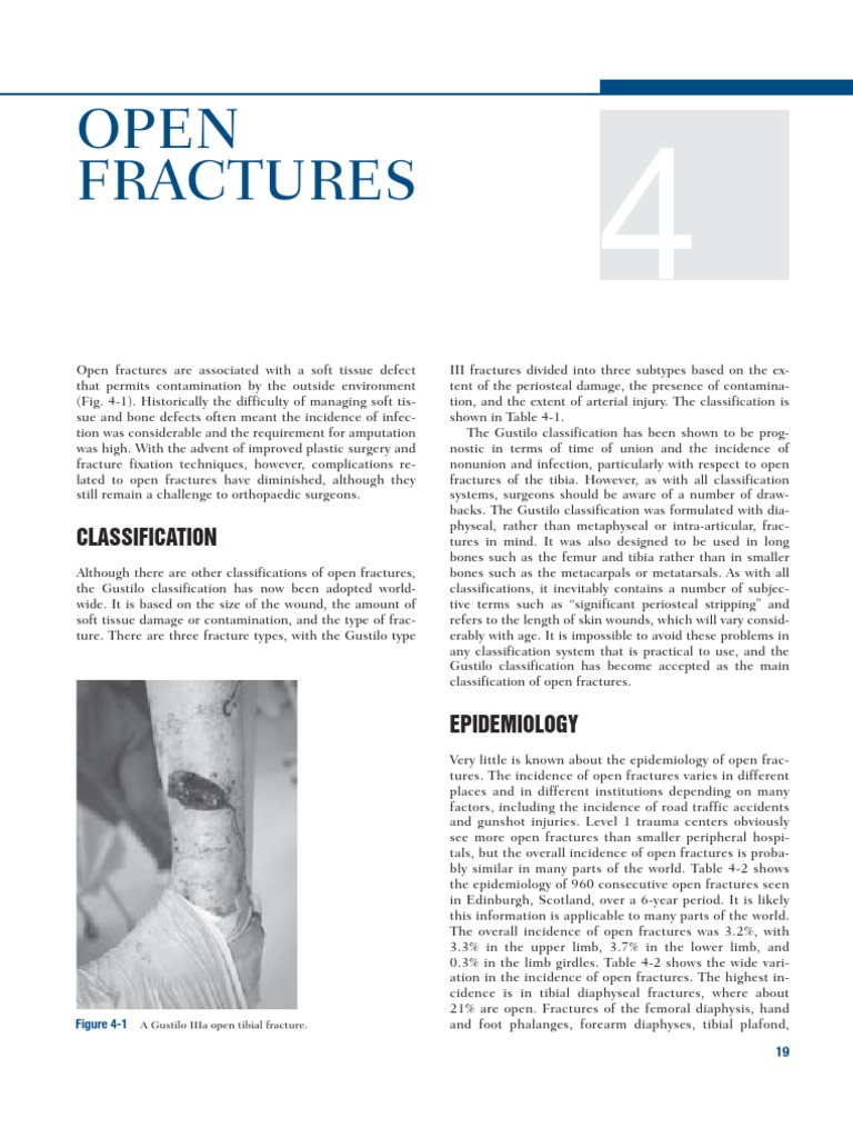 Open Fracture - Gustilo | PDF | Surgery | Wound
