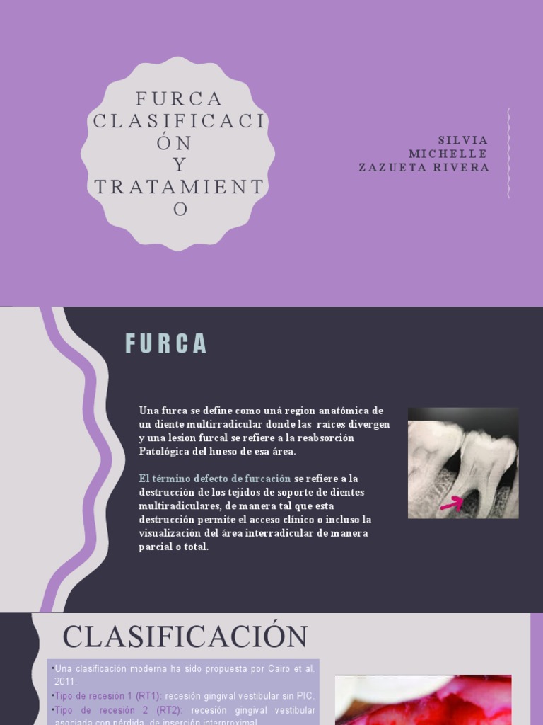 Furca Clasificación y Tratamiento | Descargar gratis PDF ...