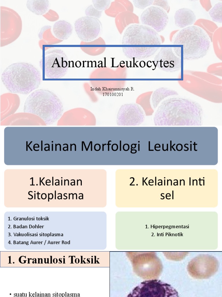 Abnormal Leukosit by Nda | PDF | Pengembangan Diri | Sains & Matematika
