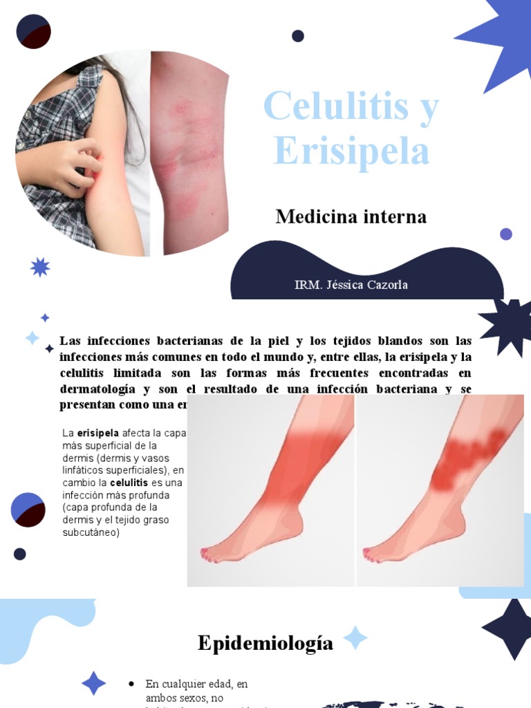 Celulitis y Erisipela | PDF | Inmunología | Epidemiología