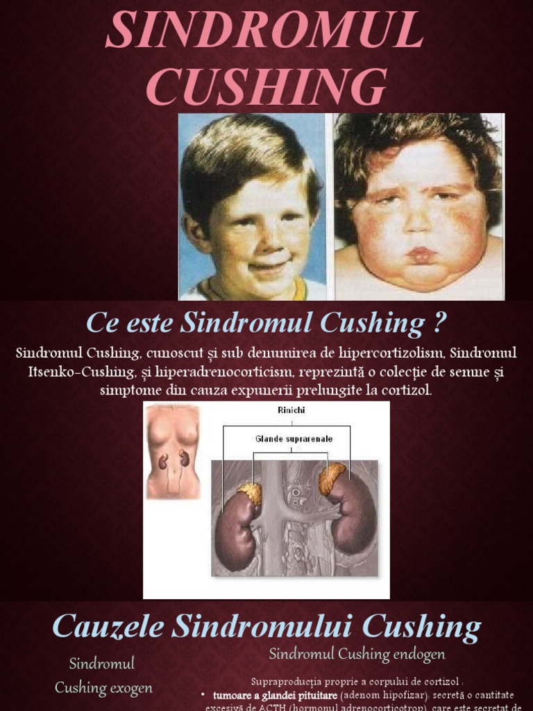 Sindromul Cushing | PDF