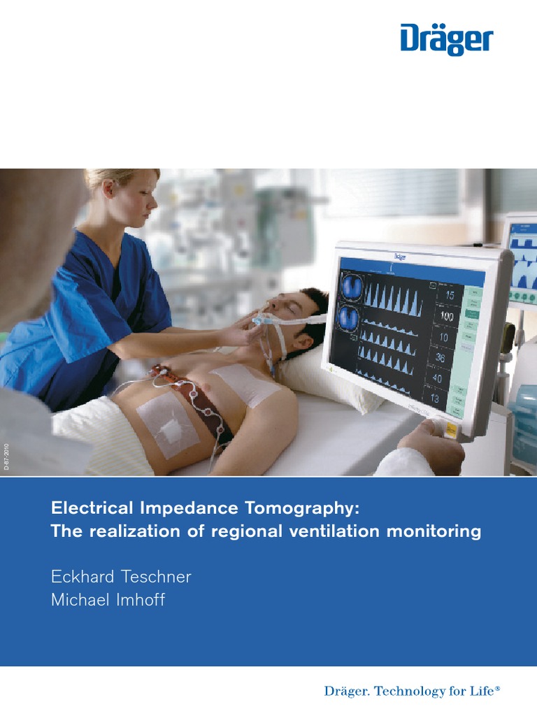 AppareilComercial EIT | PDF | Medical Imaging | Ct Scan