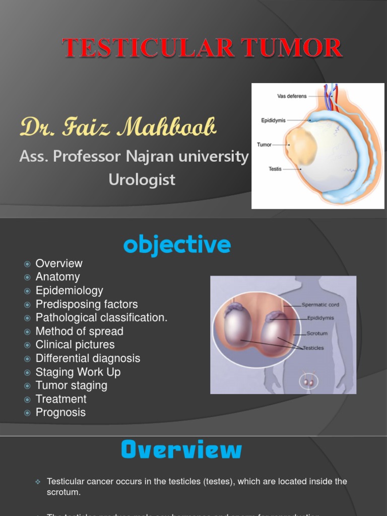 Testicular Tumor - Dr. Faiz | PDF | Testicle | Metastasis
