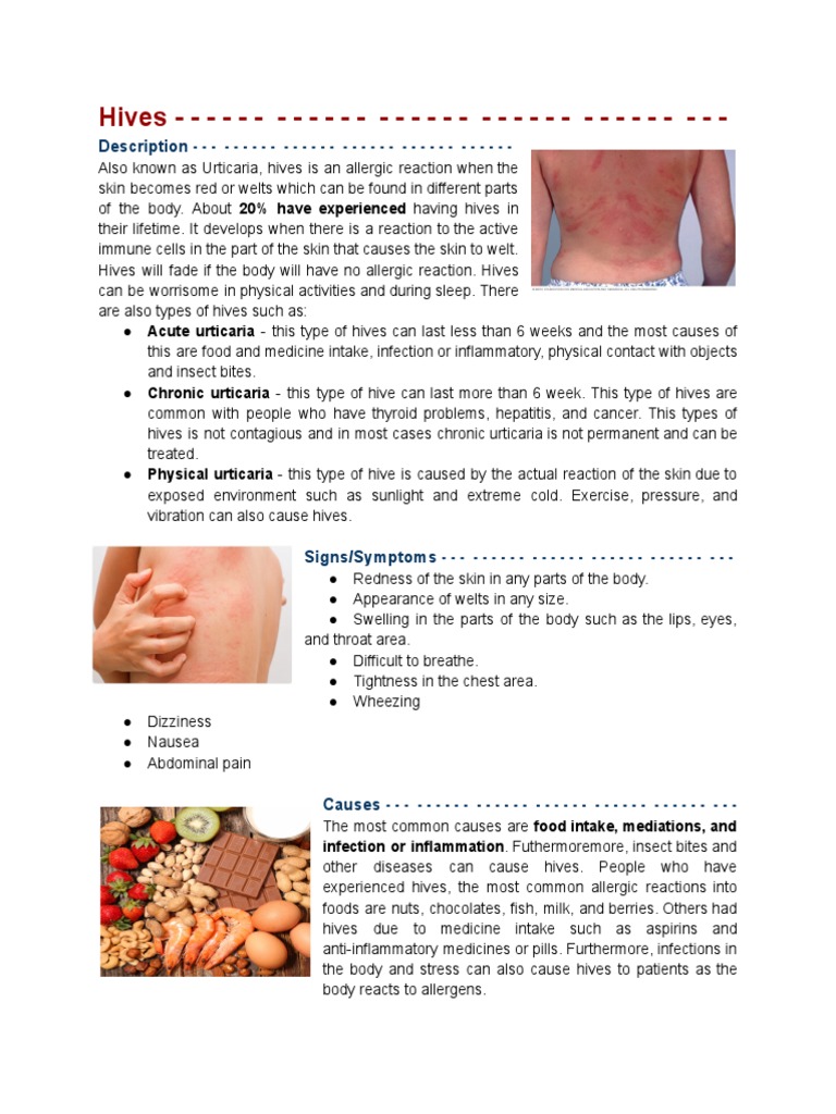 Hives | PDF | Allergy | Health Sciences