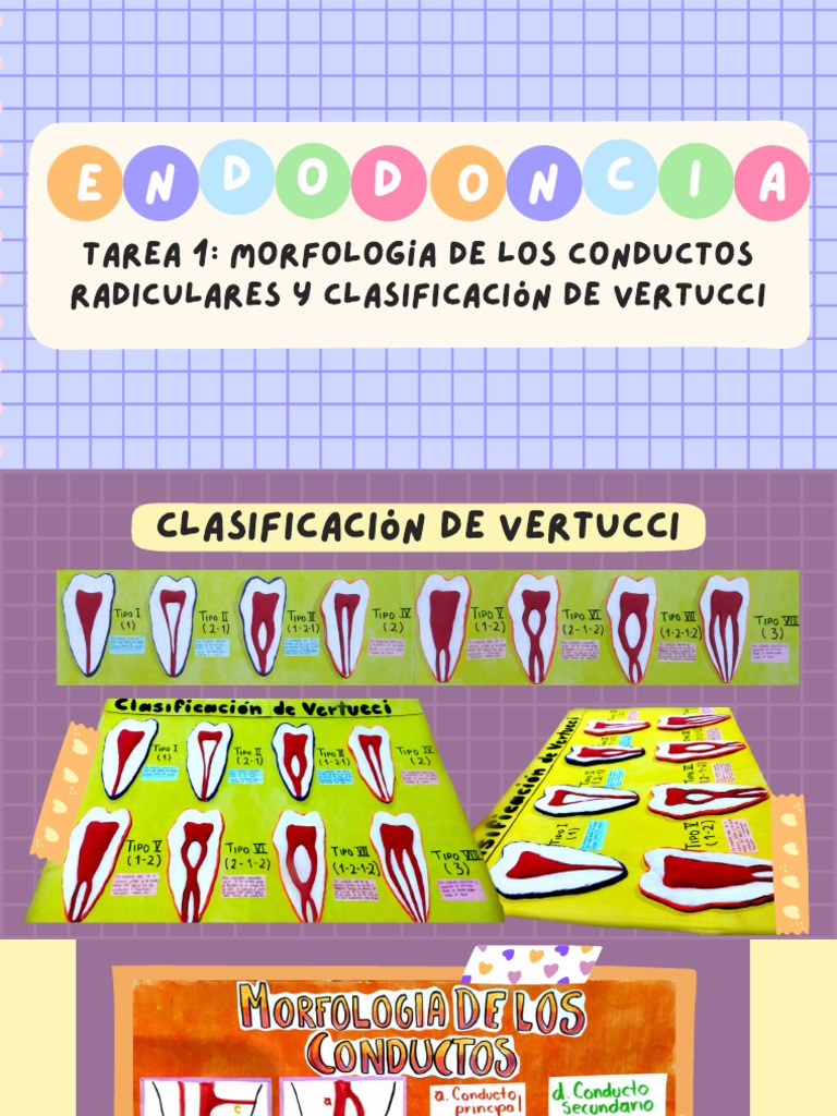 Clasificación de Vertucci en Endodoncia | PDF