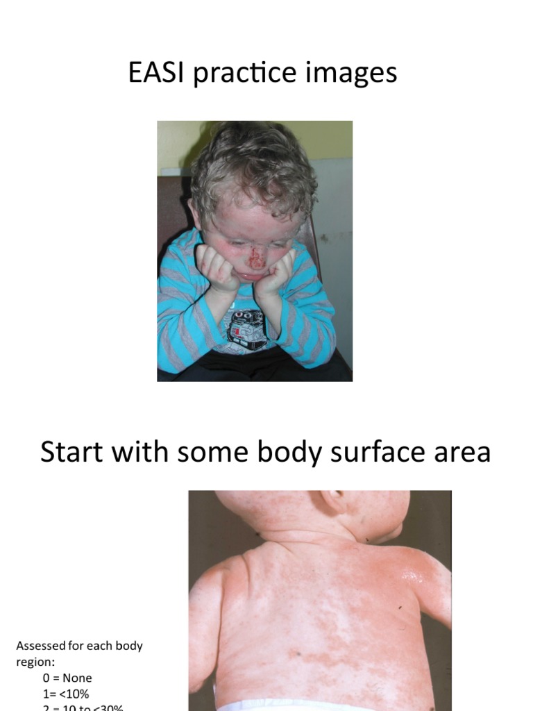 Easi Test Images | PDF