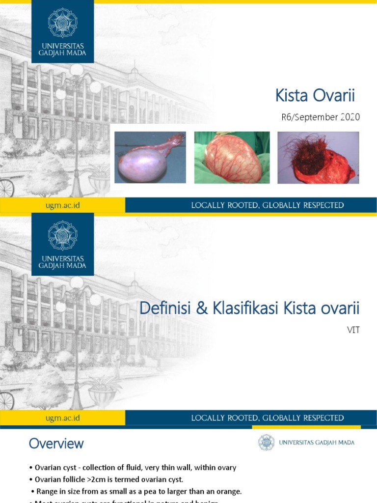 Kista Ovarii: R6/September 2020 | PDF | Ovarian Cancer | Ovary