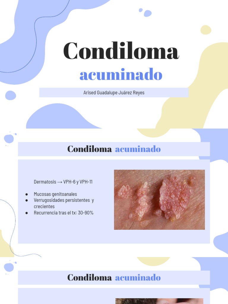 Condiloma Acuminado | PDF | Enfermedades y trastornos | Medicina CLINICA