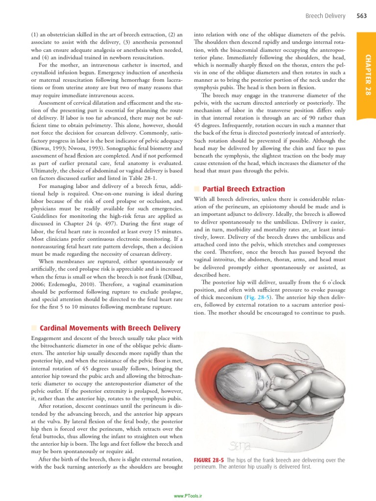 Partial Breech Extraction: FIGURE 28-5 | PDF | Childbirth | Pelvis