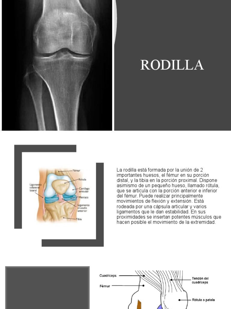Rodilla Anatomia y Proyecciones Radiologicas | PDF | Rodilla | Anatomía ...