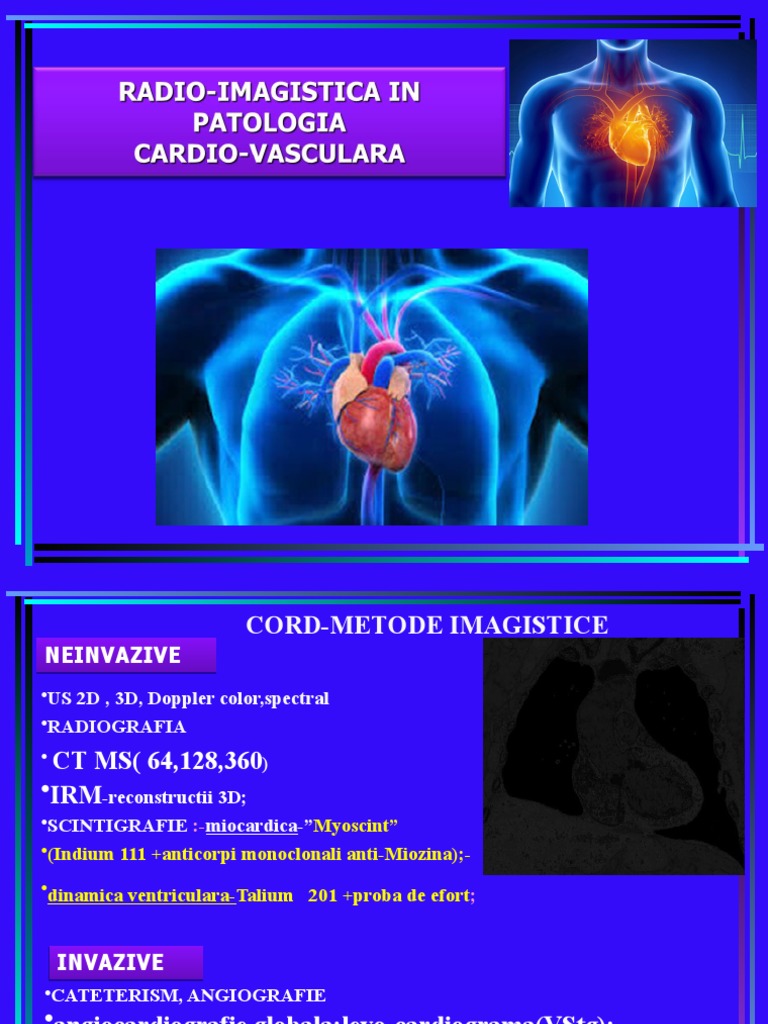 Boli Cardiace Dobindite | PDF