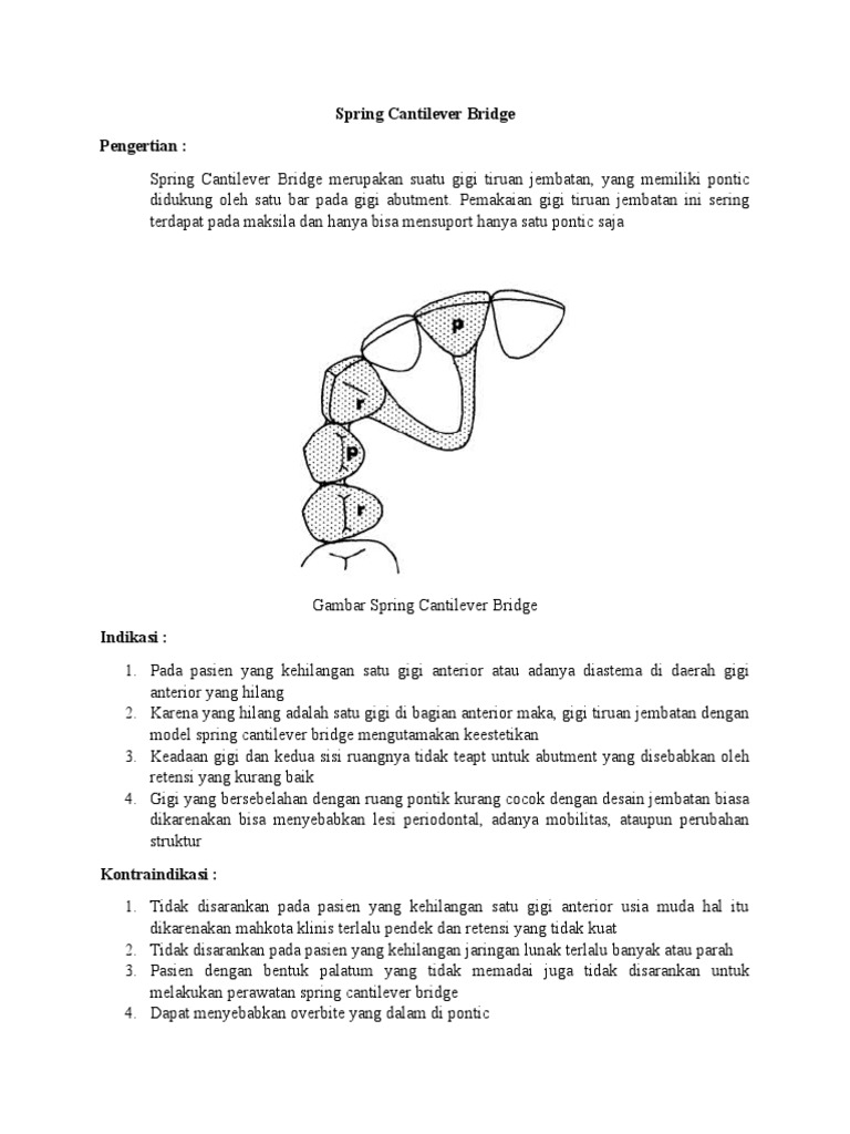 Spring Cantilever Bridge | PDF