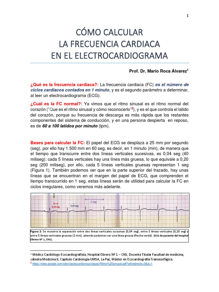 Como Calcular Frecuencia Cardiaca en ECG | PDF | Electrocardiografia ...