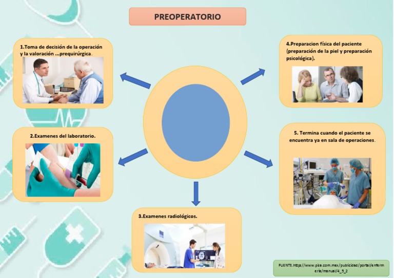 Preoperatorio Infografia | PDF