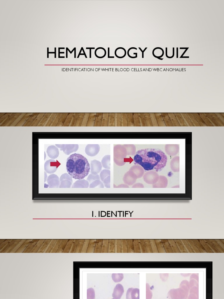 Identification of White Blood Cells and WBC Anomalies | PDF