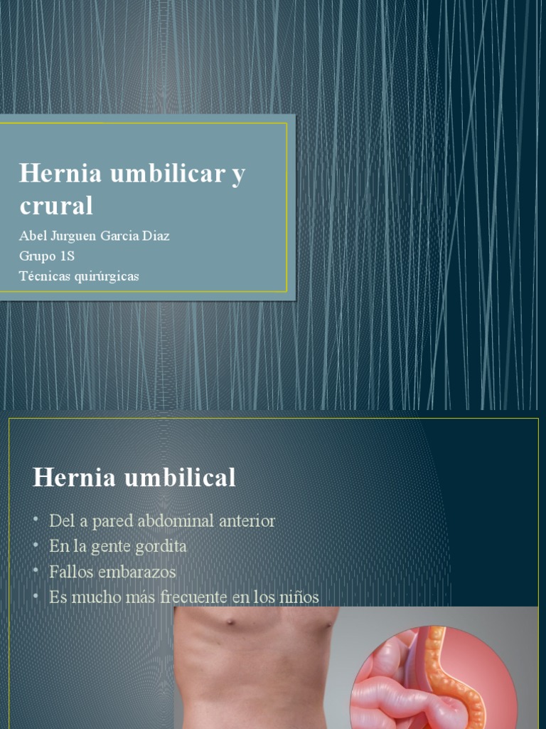Cirugía de Hernia Umbilical y Crural | PDF | Cirugía | Medicina