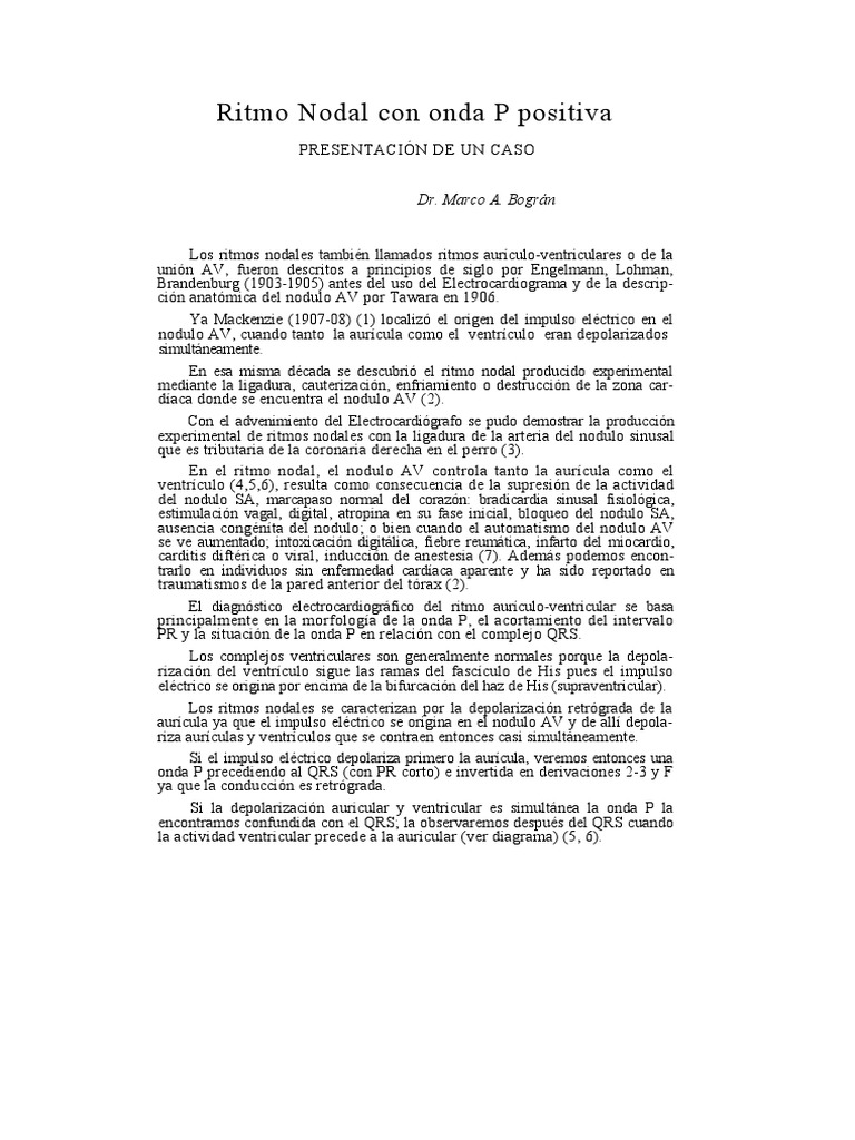 Ritmo IV o Internodal o de La Union | PDF | Electrocardiografia | Medicina