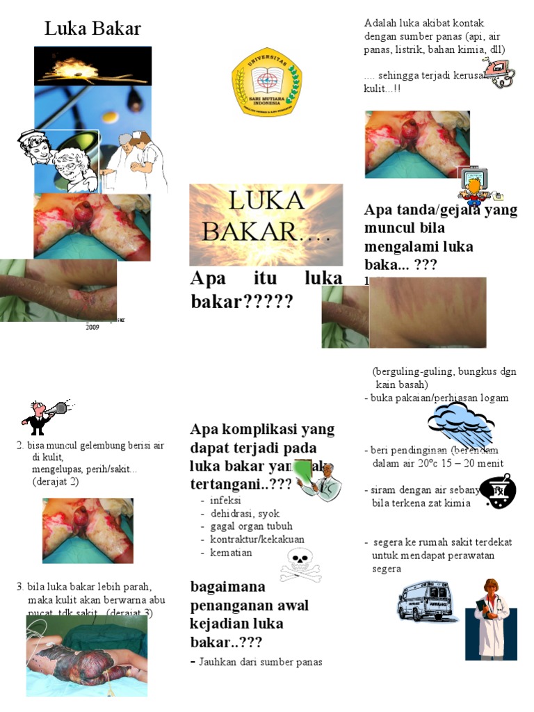 Leaflet Luka Bakar | PDF