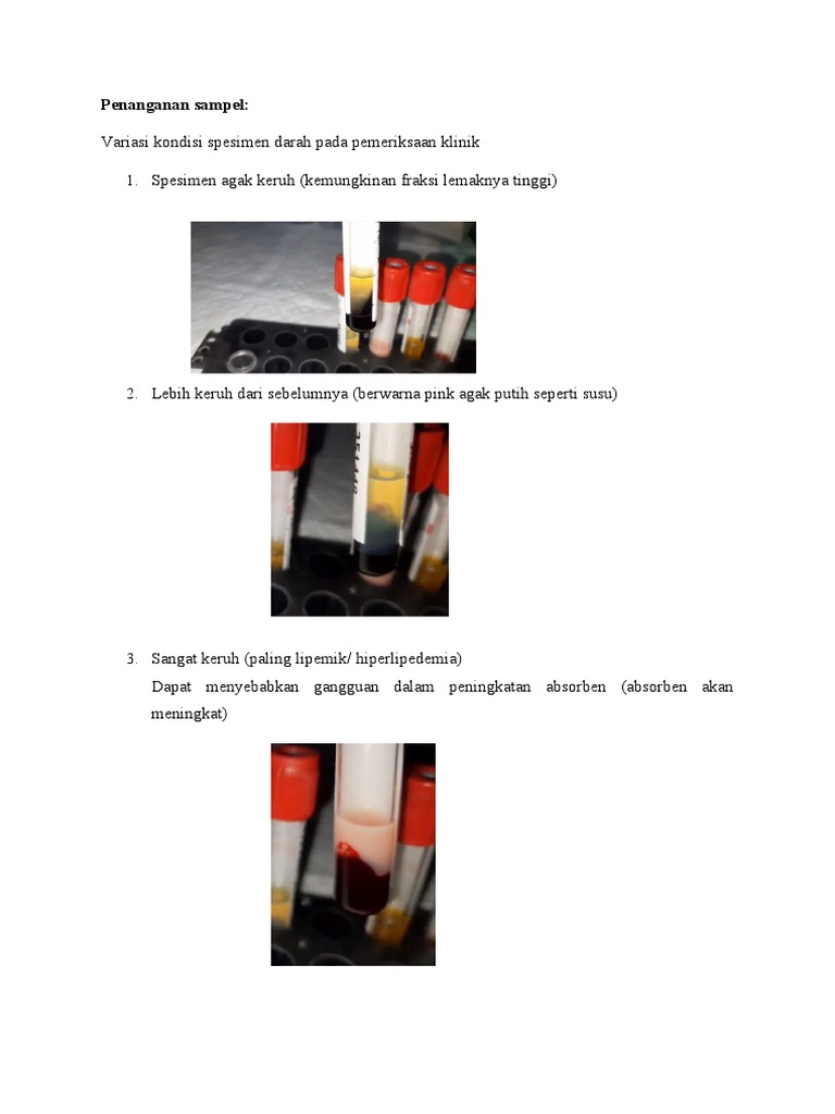 Penanganan Sampel | PDF