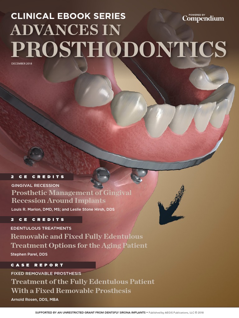 Advances in Prosthodontics | PDF | Dental Implant | Periodontology