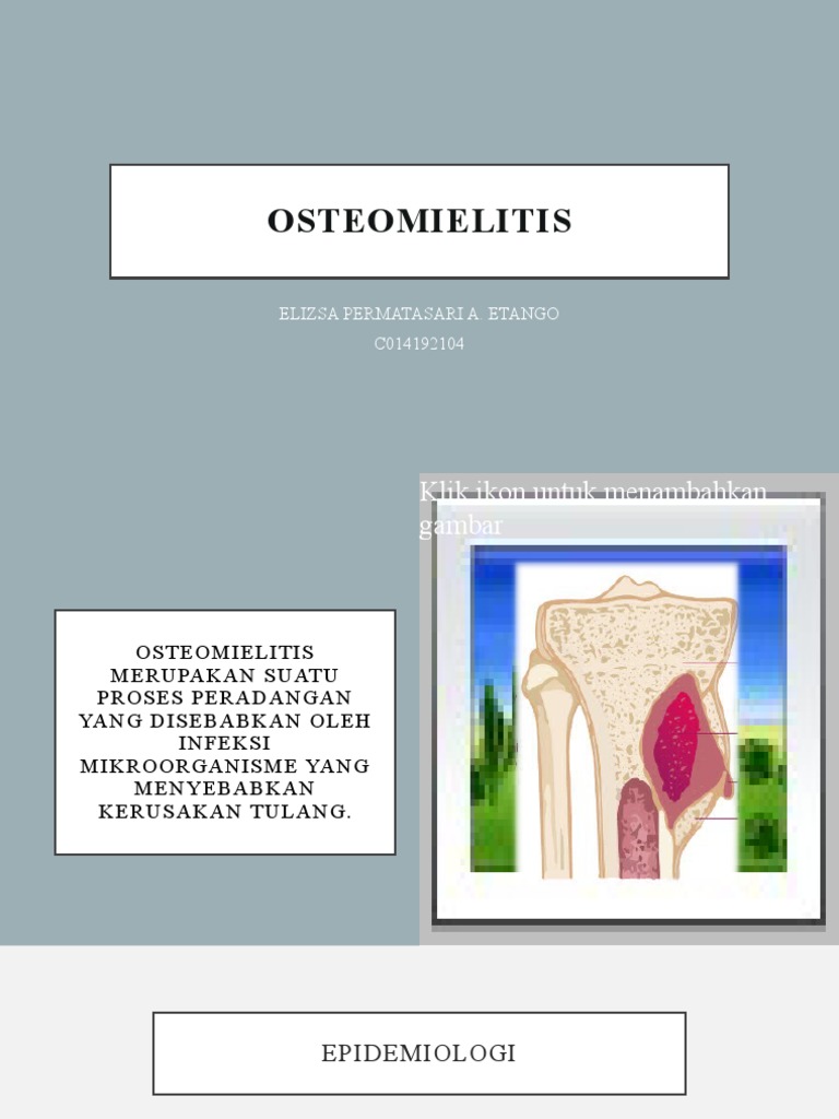 Osteomyelitis | PDF
