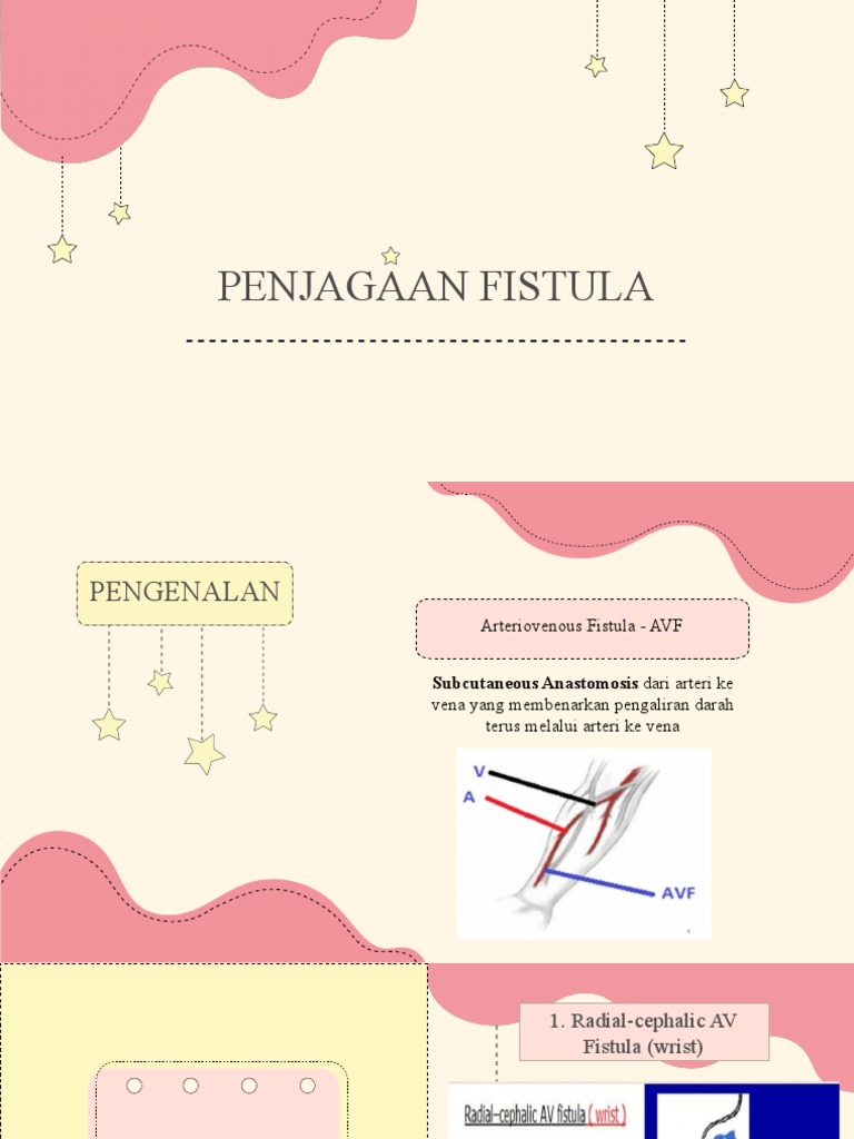 Penjagaan Fistula | PDF