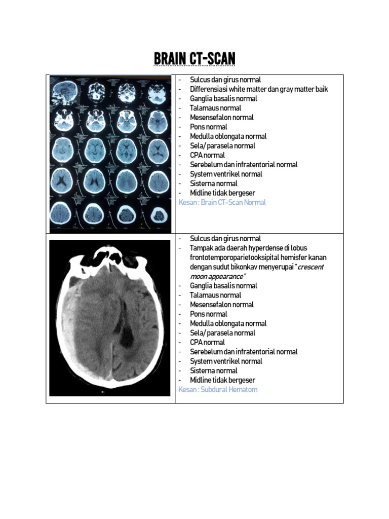 Brain CT-Scan | PDF | Memasak, Makanan, & Anggur