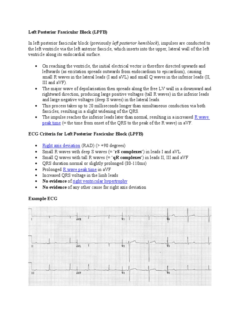 Left Posterior Fascicular Block | PDF | Electrocardiography | Medical ...