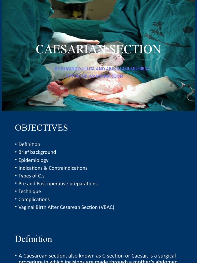 Everything You Need to Know About C-Sections | PDF | Caesarean Section ...