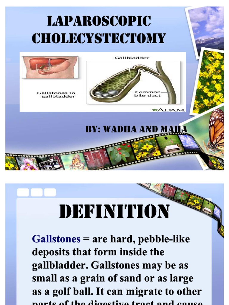 Laparoscopic Cholecystectomy | PDF | Gallbladder | Surgery