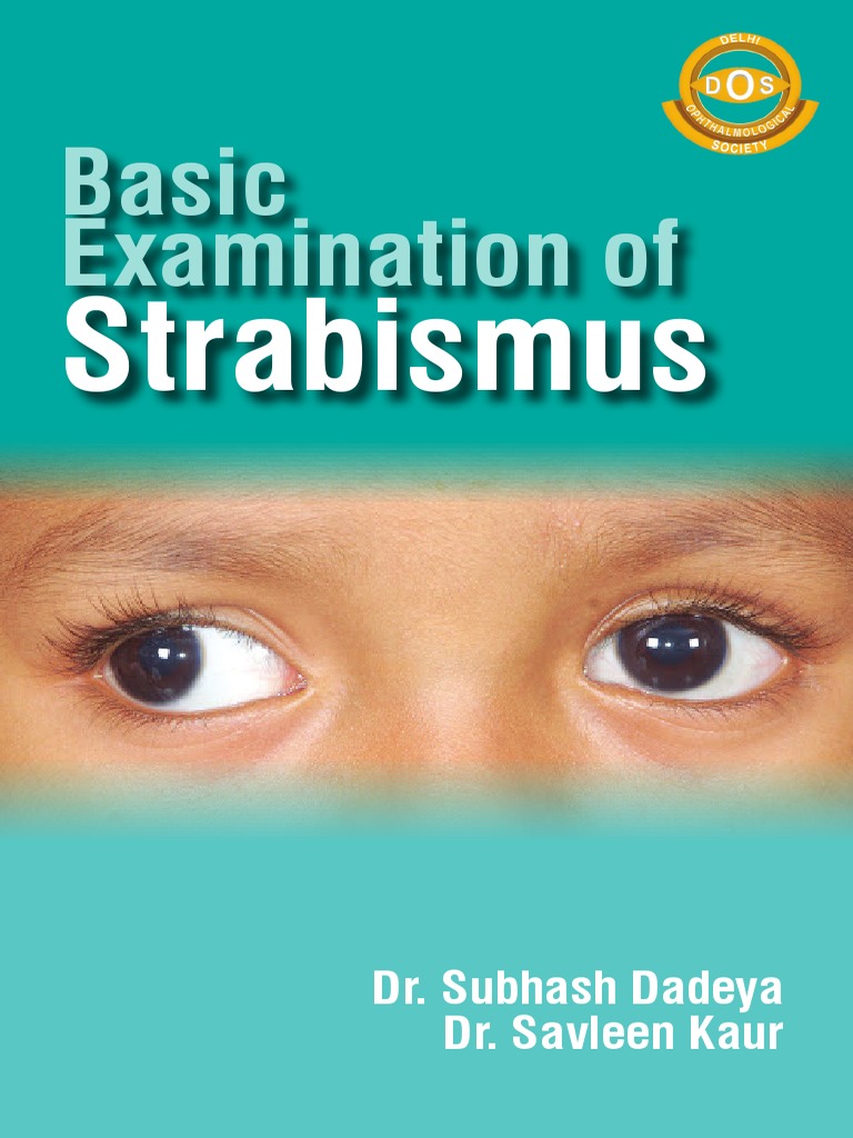 Basic Examination of Strabismus | PDF | Visual Acuity | Human Eye