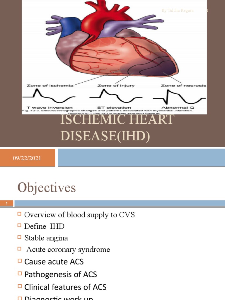 Ischemic Heart Disease (Ihd) : by Tolcha Regasa | PDF | Myocardial ...