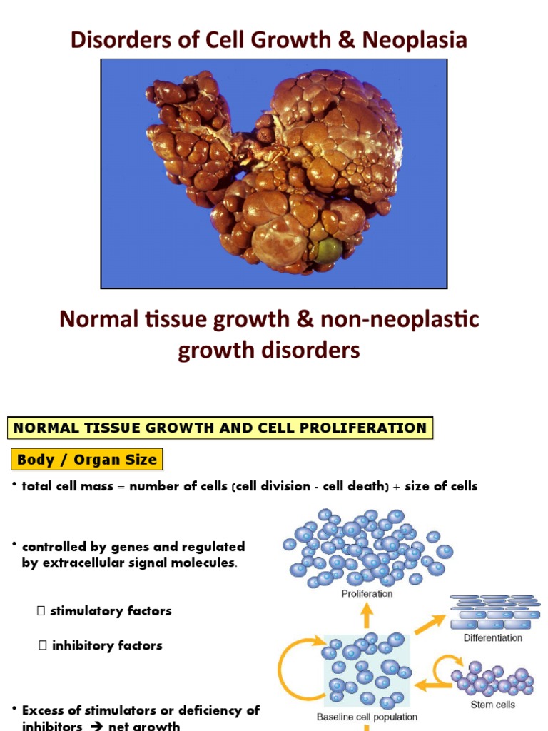 Disorders of Cell Growth & Neoplasia | PDF | Neoplasms | Adenoma