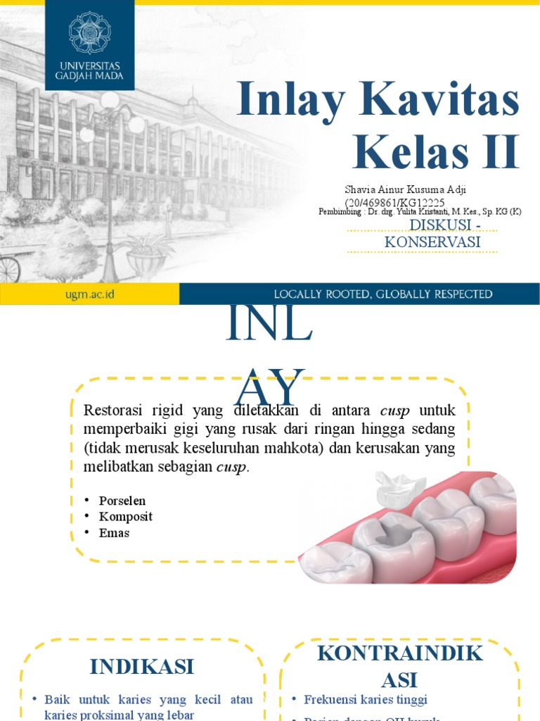 Inlay Kelas 2 | PDF