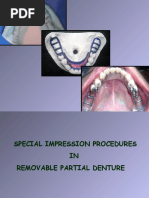 Impression techniques in RPD | PDF | Dentures | Dentistry Branches