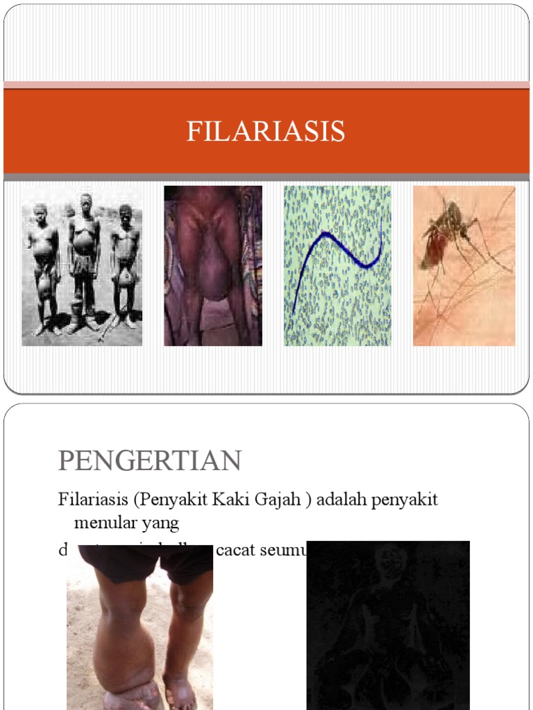 MEKANISME PENULARAN FILARIASIS | PDF