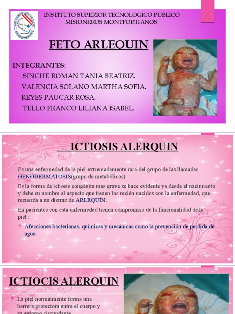 1 Feto Arlequin (Miss Luz) | PDF | Ciencias de la Salud | Enfermedades ...