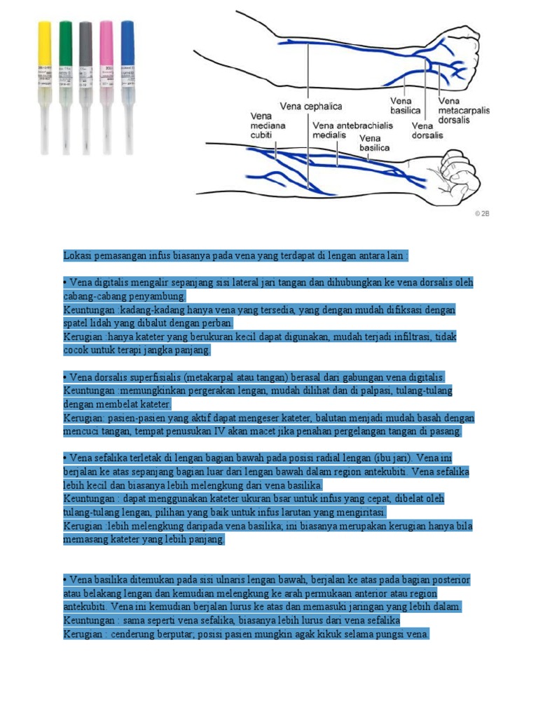 Lokasi Pemasangan Infus Biasanya Pada Vena Yang Terdapat Di Lengan ...