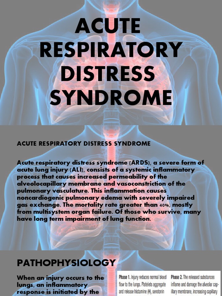 Acute Respiratory Distress Syndrome | PDF | Lung | Hypoxia (Medical)