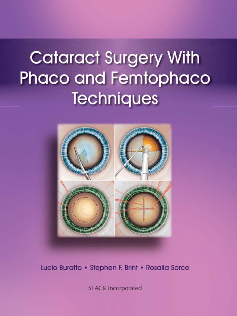 Cataract Surgery With Phaco & Femtophaco Technique | PDF ...