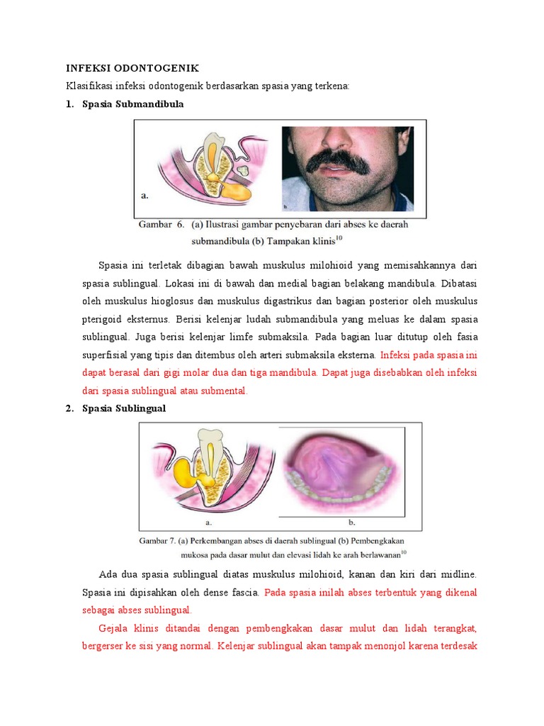 Infeksi Odontogenik: Klasifikasi dan Penanganan | PDF | Sains & Matematika