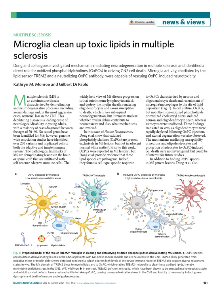 Microglia Clean Up Toxic Lipids in Multiple Sclerosis: News & Views ...