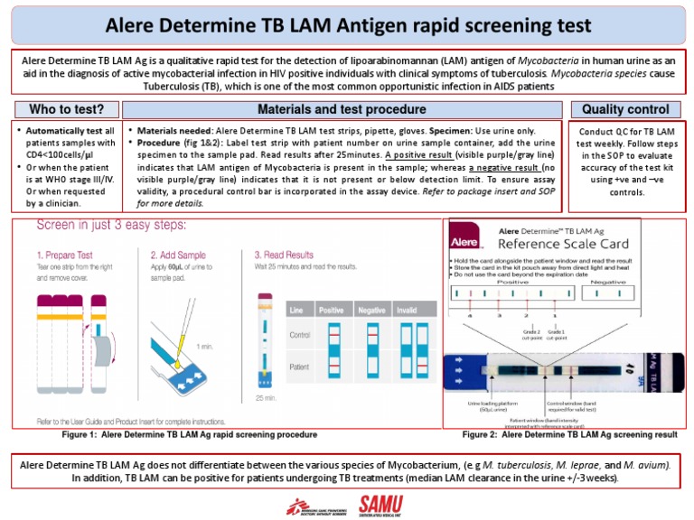 Urine TB LAM - Testing Job Aid - MSF | PDF