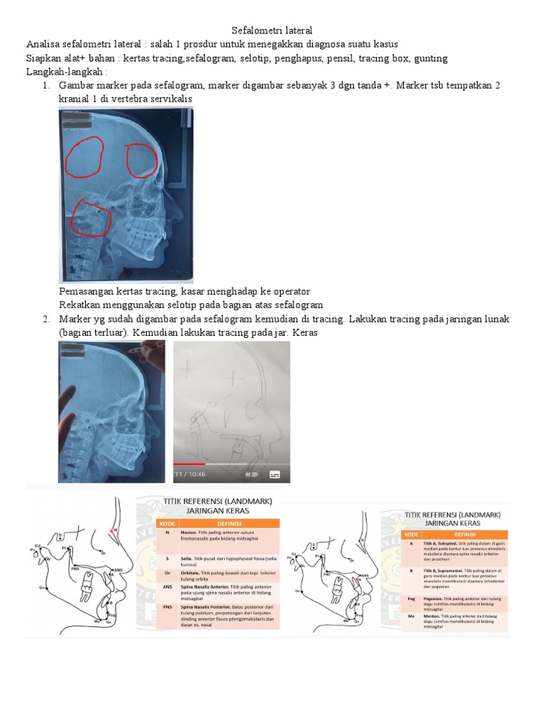 Sefalometri Lateral | PDF