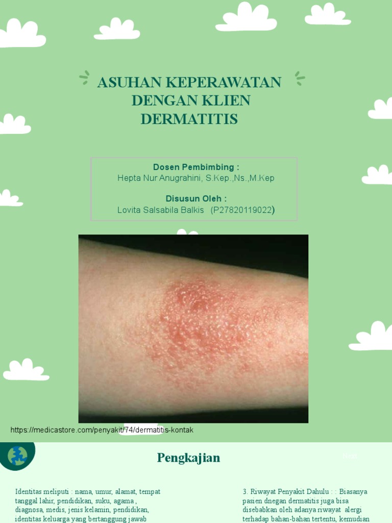 Askep Dermatitis | PDF