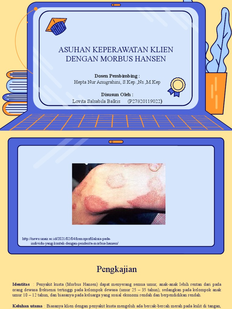 Askep Morbus Hansen | PDF | Kesehatan Holistik